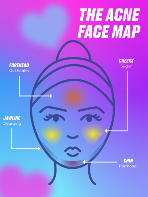 Face Mapping: What Do Your Spots Mean? - Beauty Bay Edited